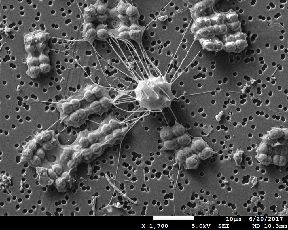 Cyanobacterial and Algal Toxins at the Land-Sea Interface along the ...
