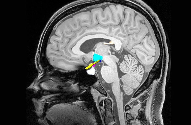 Neurobiologists help untangle the brain’s life-support network